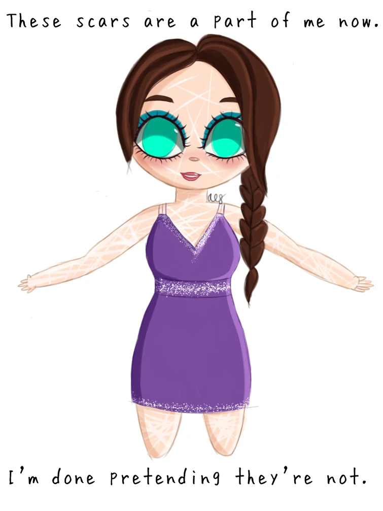 Biana's scars | Fandom