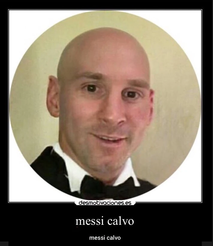 Messi calvo | Fandom