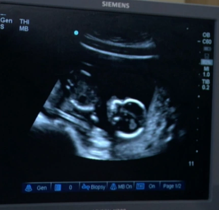 Baby Carter | EastEnders Wiki | Fandom