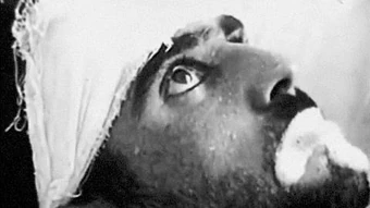 Rabies In Humans