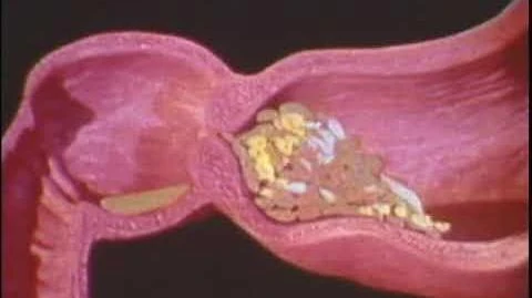 I Am Joe's Stomach | Educational Film Wiki | Fandom