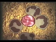 Inflammation | Educational Film Wiki | Fandom