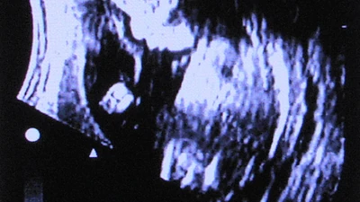 Discuss Everything About Elfen Lied Wiki | Fandom