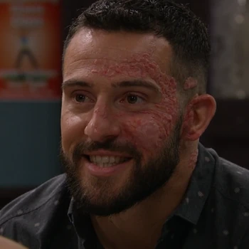 Ross Barton | Emmerdale Wiki | Fandom