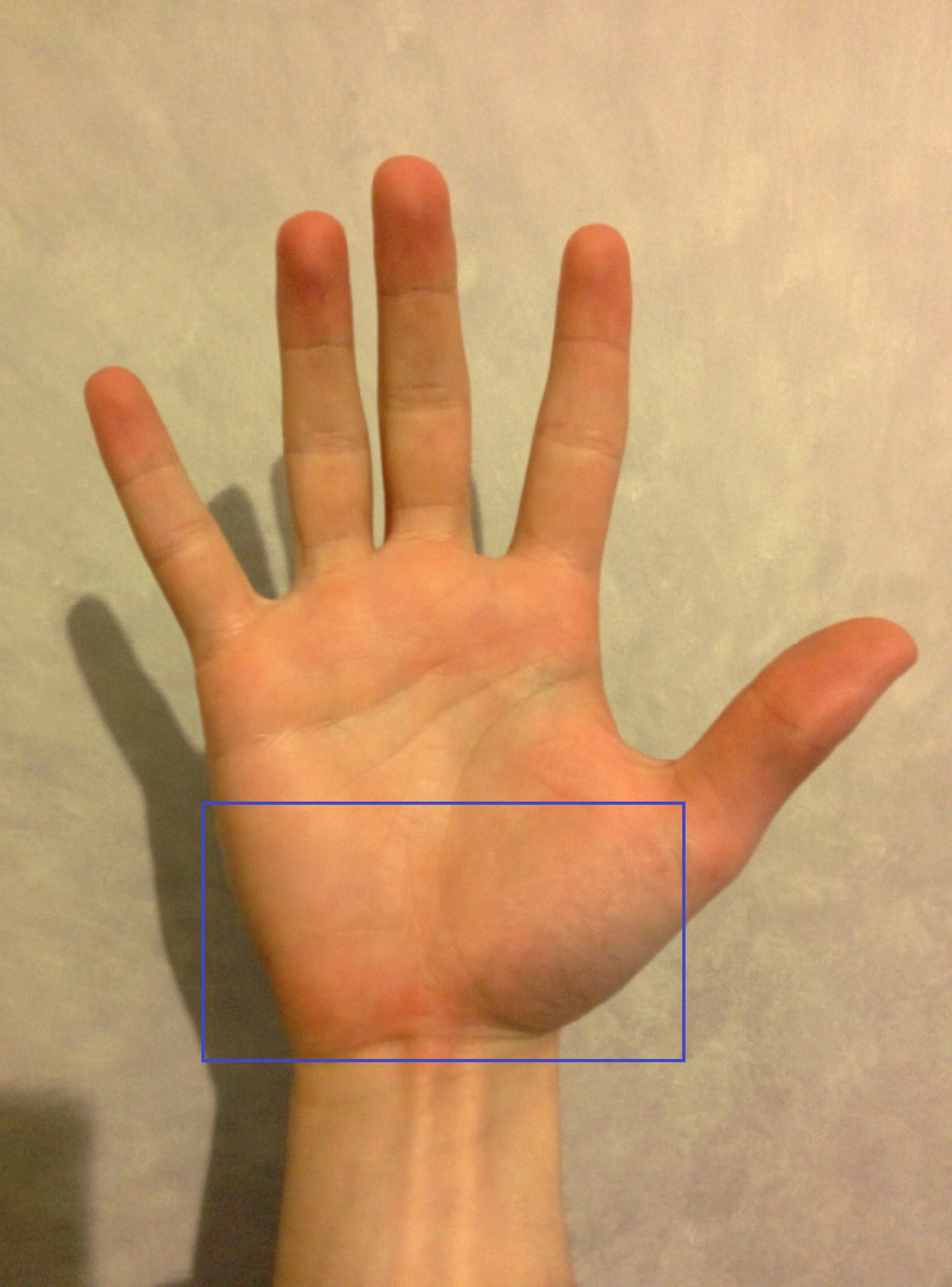 Palm Strike | Evolutionary Self Protection Wiki | Fandom