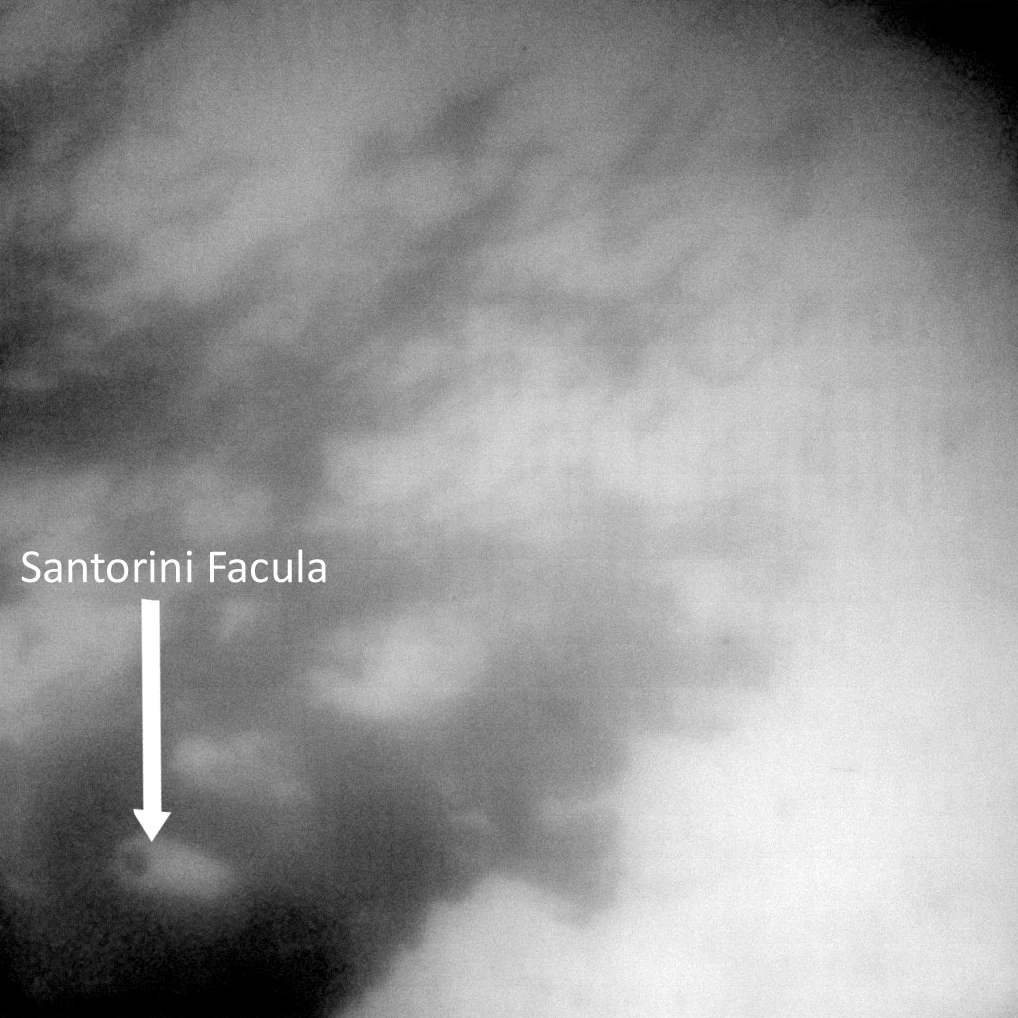 Santorini Facula | 地外地形數據庫 | Fandom