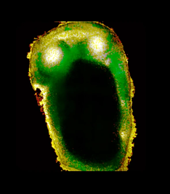 Outer (Entities) | Fandom