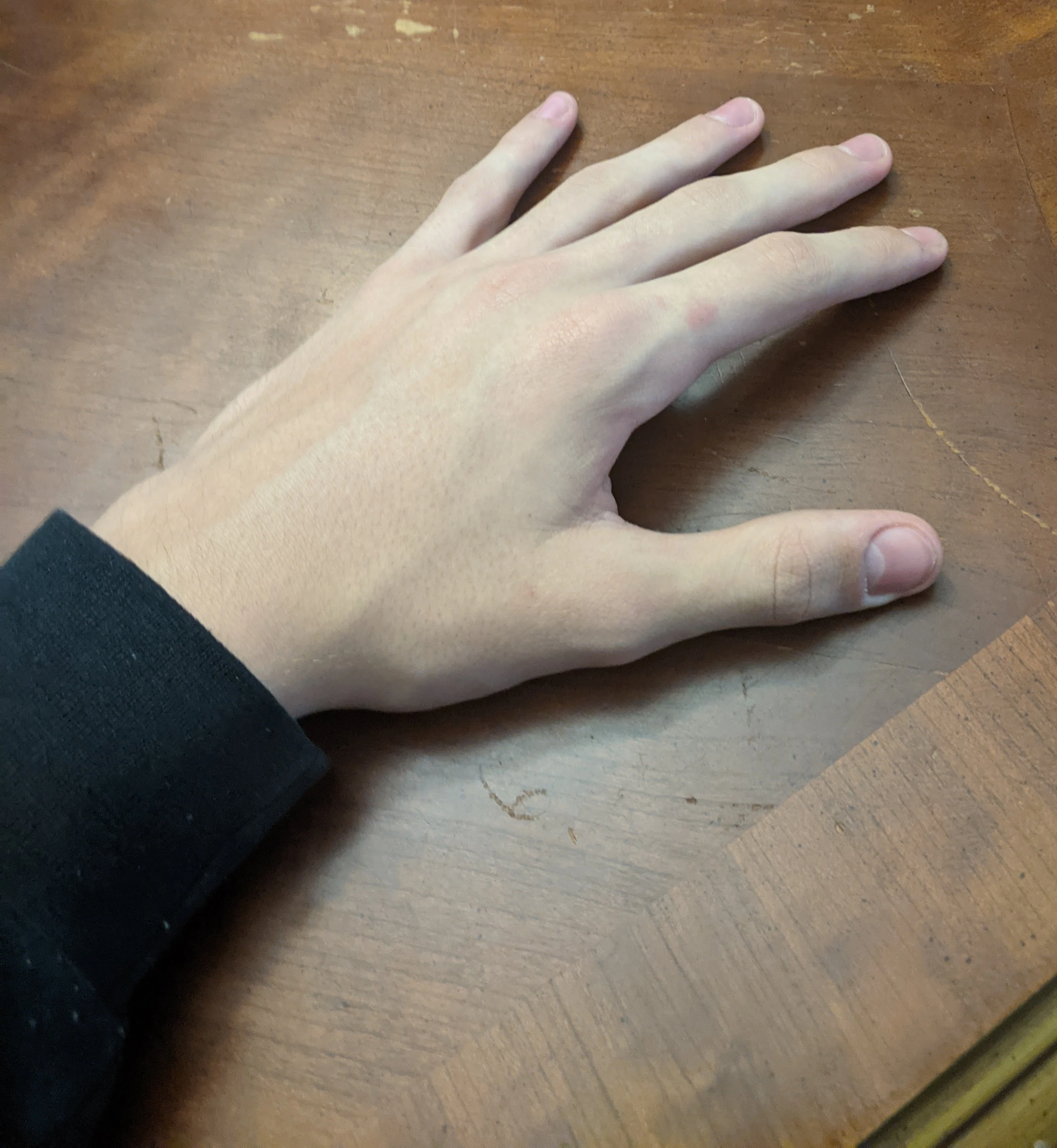 Hand Reveal | Fandom