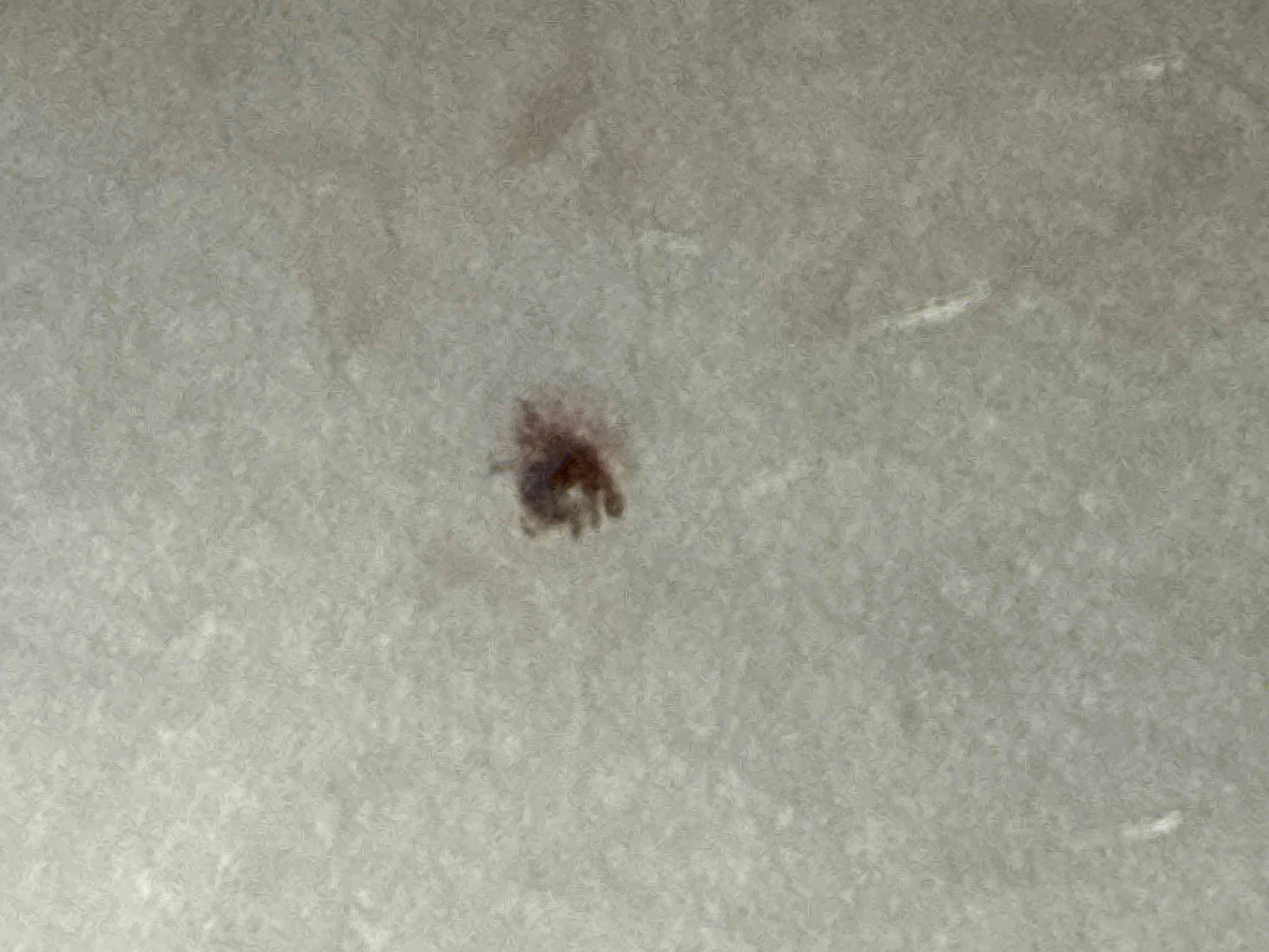 How does one get a tick off ya | Fandom