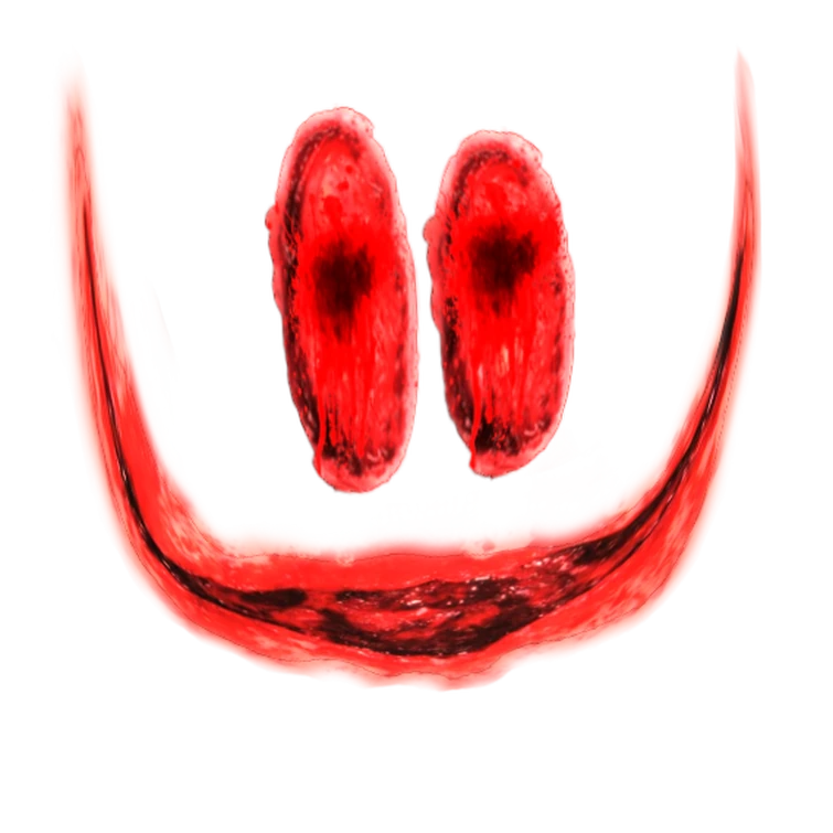 (DISTURBING FACES & BLOOD WARNING) A-60 & A-100 Redesign | Fandom