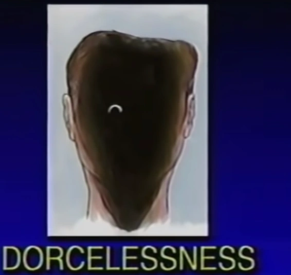 so yk dorcelessness the emotion??? | Fandom