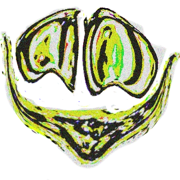 fleshy face battl | Fandom