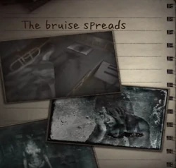 The tattoo bruise (Notes) | Fatal Frame Wiki | Fandom