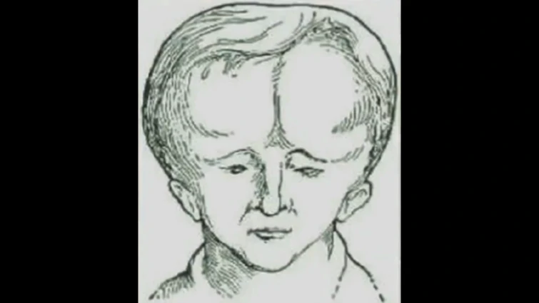 Melonhead | Fiction Taxonomy Wiki | Fandom