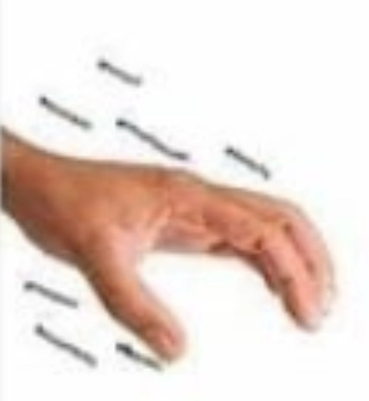 The Hand | Floppapedia Revamped Wiki | Fandom