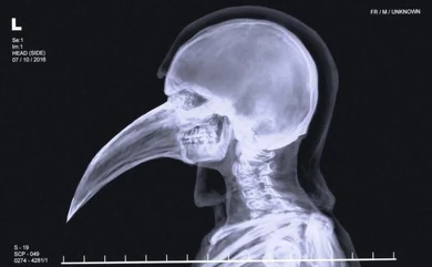 SCP-049 | Fundação SCP Global Wiki | Fandom