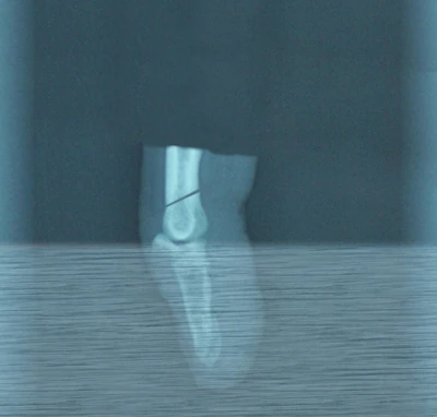 SCP-170 | Fundação SCP Global Wiki | Fandom