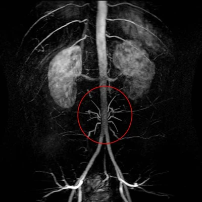 SCP-940 | Fundação SCP Global Wiki | Fandom