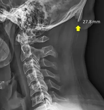 SCP-067-PT | Wiki Fundação SCP | Fandom