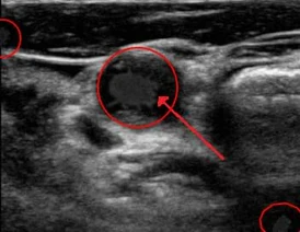 SCP-940 | Wiki Fundação SCP | Fandom