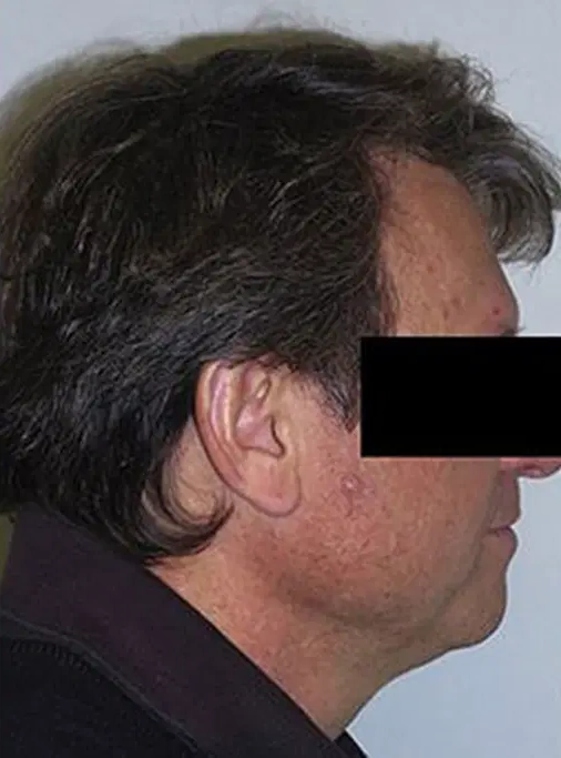 SCP-1761 | Wiki Fundação SCP | Fandom