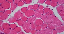 SCP-763 | Wiki Fundação SCP | Fandom