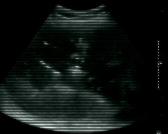 SCP-885 | Wiki Fundação SCP | Fandom