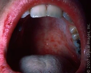 SCP-593 | Wiki Fundação SCP | Fandom