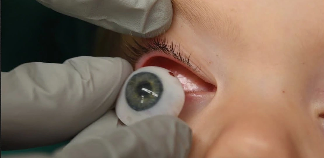 SCP-1078 | Wiki Fundação SCP | Fandom