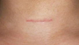 SCP-481 | Wiki Fundação SCP | Fandom