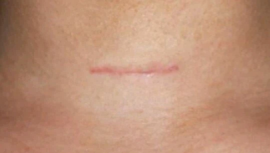 SCP-481 | Wiki Fundação SCP | Fandom