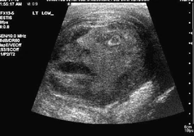 SCP-1263 | Wiki Fundação SCP | Fandom