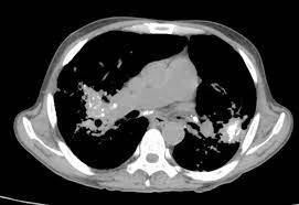 SCP-489 | Wiki Fundação SCP | Fandom
