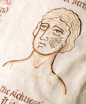 Greyscale | Wiki of Westeros | Fandom