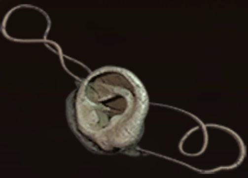 Ear Replacement | Gold Fever Wiki | Fandom
