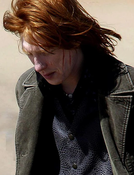Bill Weasley Scar