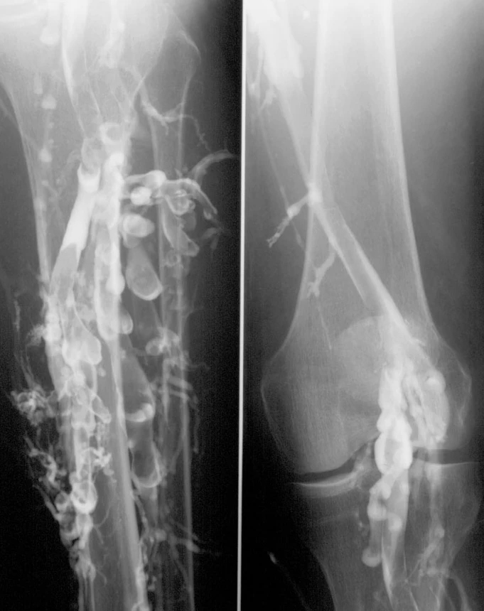 Venogram | House Wiki | Fandom