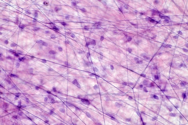 Connective Tissue | How Cells Make Tissues Wiki | Fandom