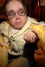 Eric the Midget | Howard Stern Official Wiki | Fandom