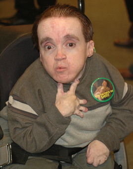 Eric the Midget | Howard Stern Official Wiki | Fandom