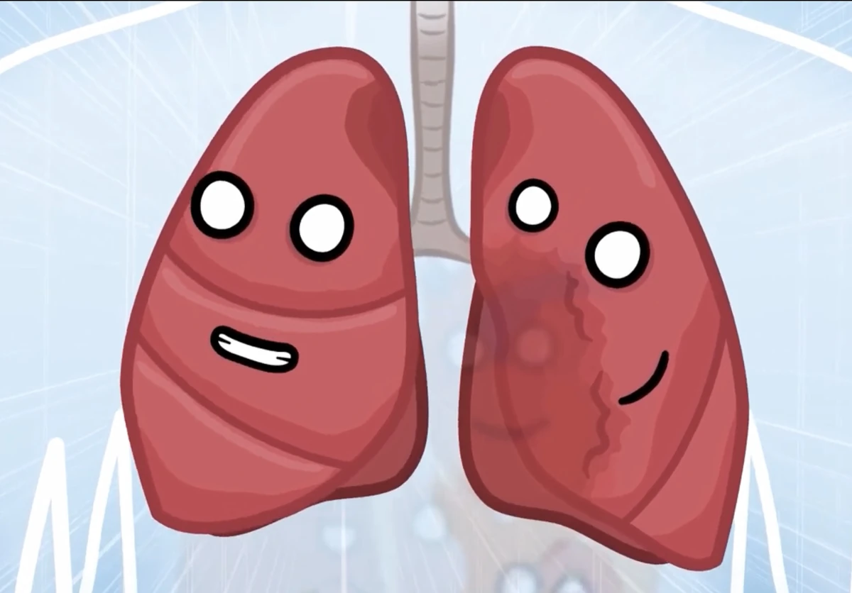 Pulmones | Wiki Human Buddy Español | Fandom