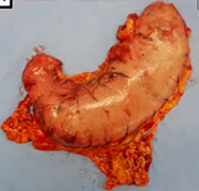 Stomach | Human Buddy Wiki | Fandom