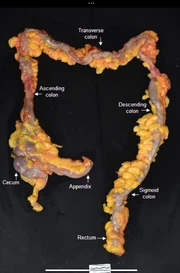 Intestines | Human Buddy Wiki | Fandom