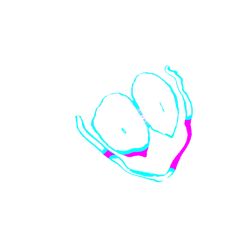 Æ-35 | Interminable Rooms: Æ Section Wiki | Fandom