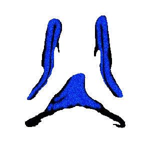 XH-3 | Interminable Rooms Fan Ideas Wiki | Fandom