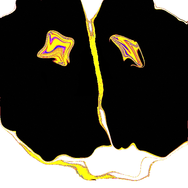 XXXX(midx)-35 (the goober man who is better than xx midx-35) | Interminable Rooms Fan Ideas Wiki ...