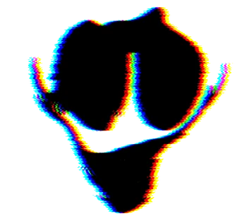 DST-1 (The Decaying Lurker) | Interminable rooms: Remade Wiki | Fandom