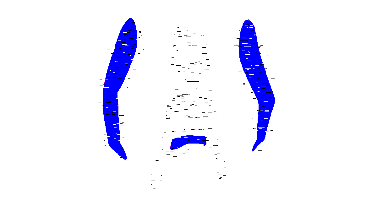 V-60 (The Volumemonster) | Interminable Rooms V Section Remake Wiki ...