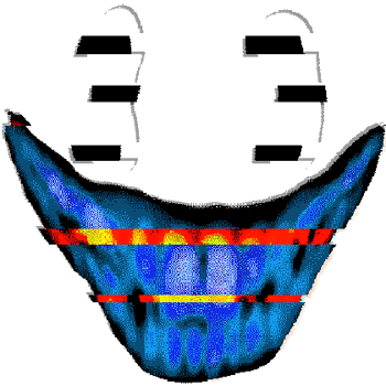 XU-5 | I R - U Section Wiki | Fandom