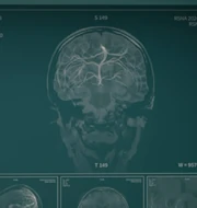 Najin (parasite) | Gyeongseong Creature Wiki | Fandom